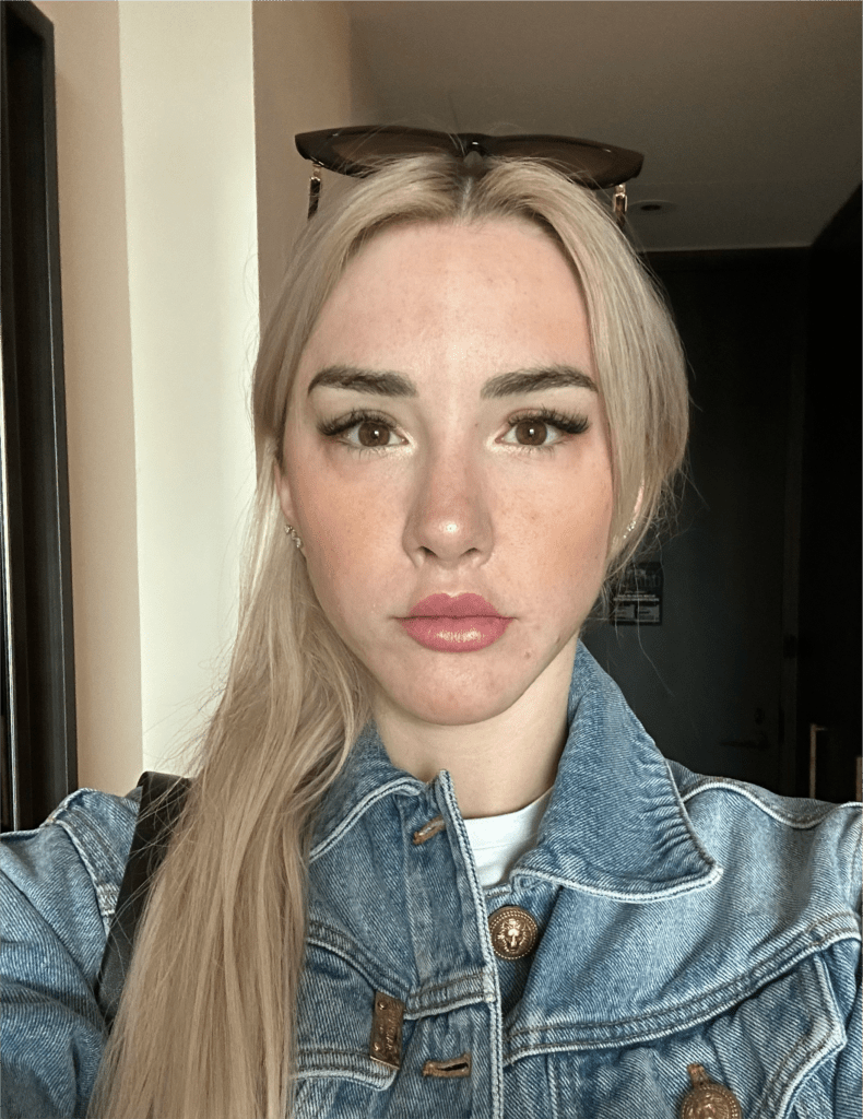 Update May 2023: Got sick. Finally healing. Beware of mold. - The Lion Diet